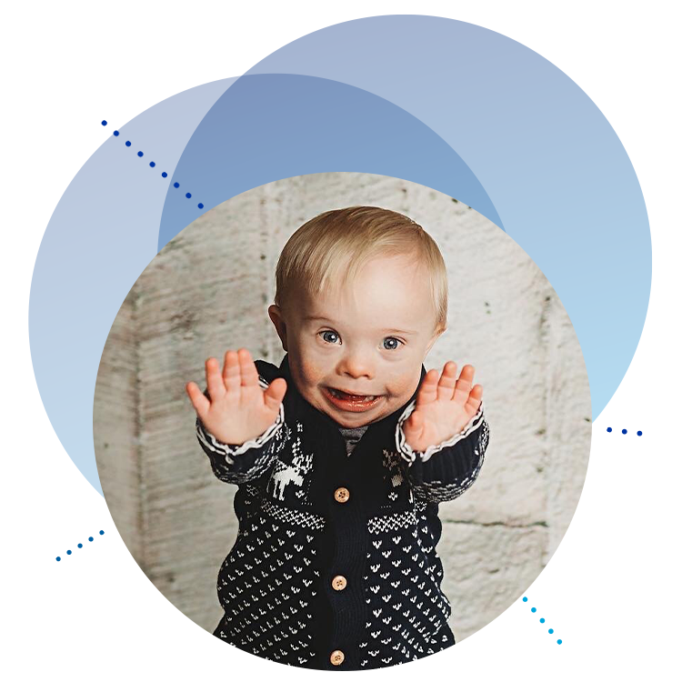 Luke's Tube Feeding Journey - Down Syndrome | Compleat®